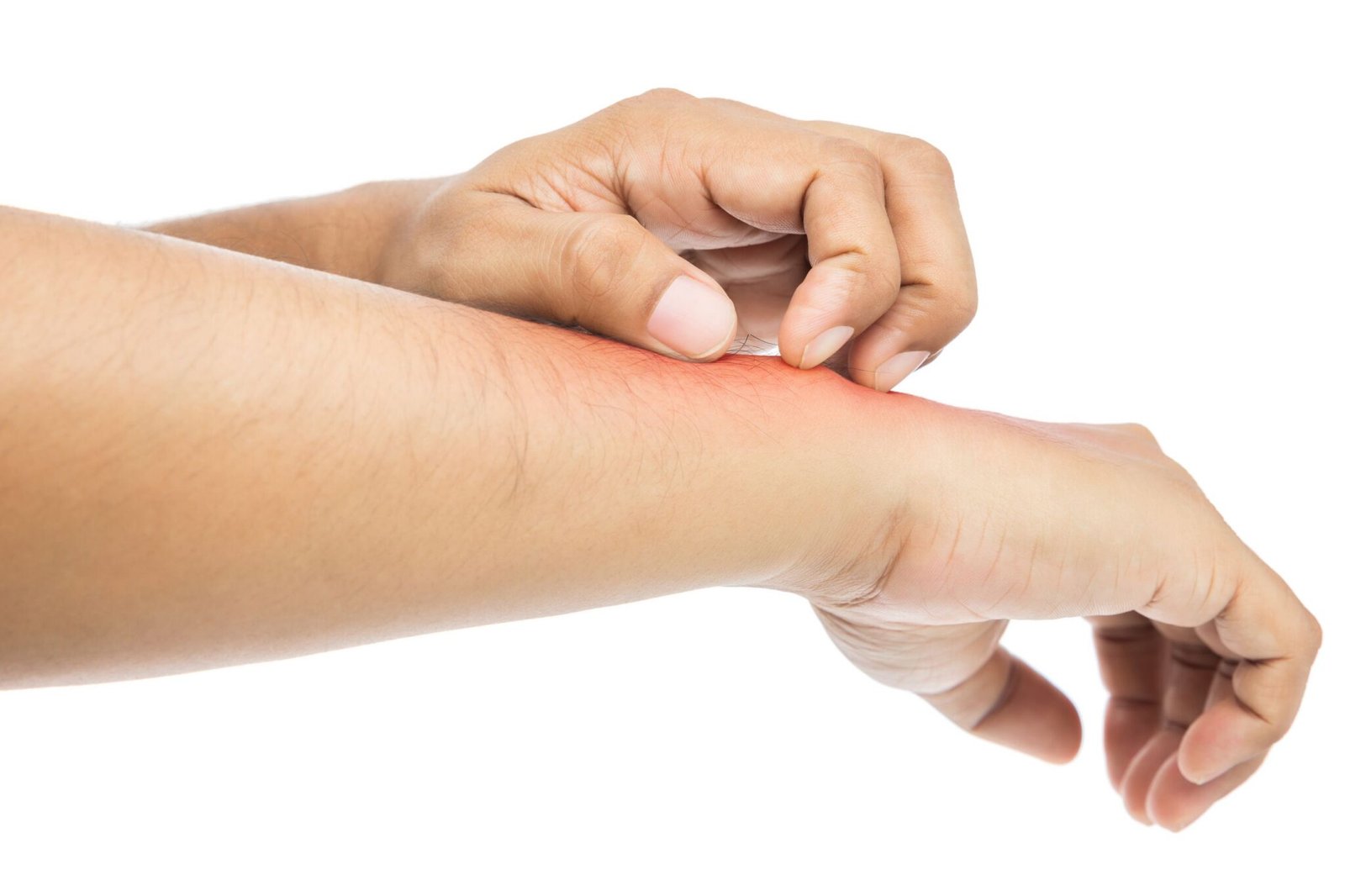 Itching/Allergies – Yuvanaa Skin Clinic